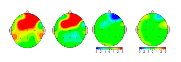 Comparing Aires Tech EMF Protection: Functionality and Choices ...